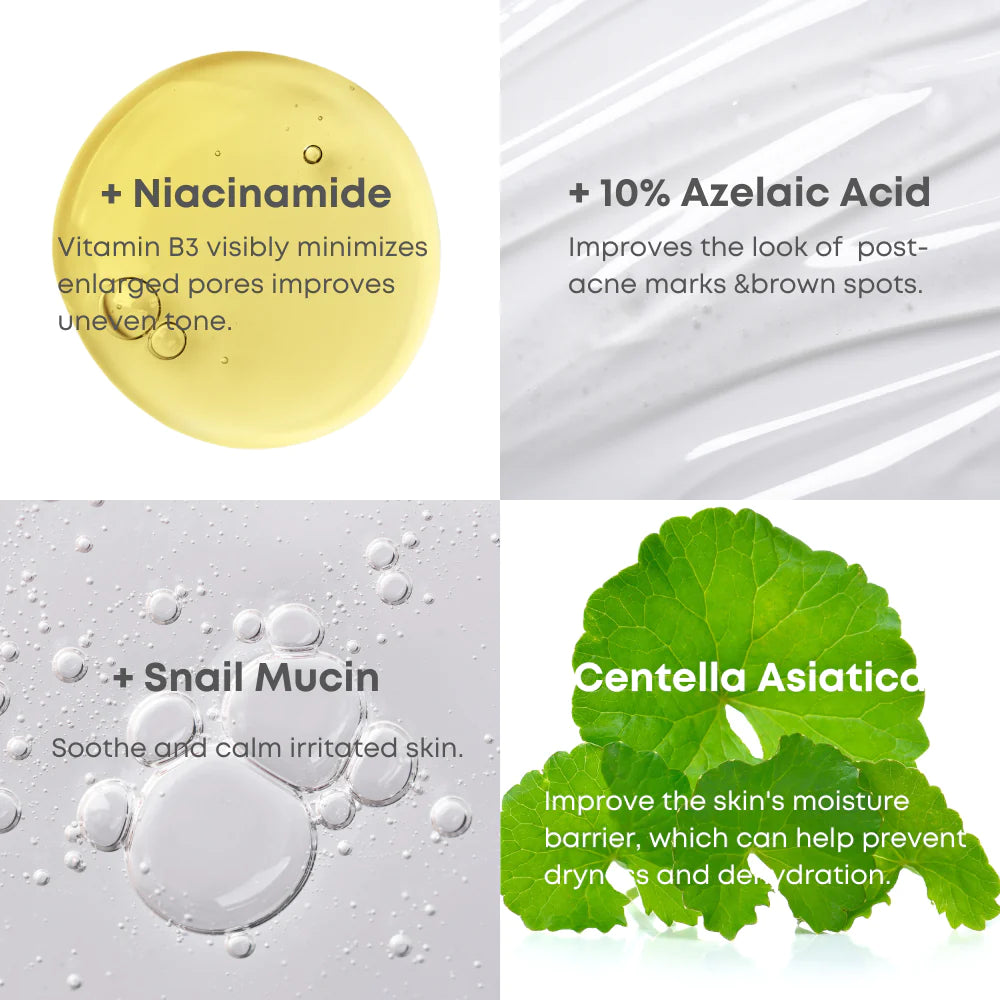 NINELESS A-Control 10% Azelaic Acid Serum 30ml – SoKoSkins